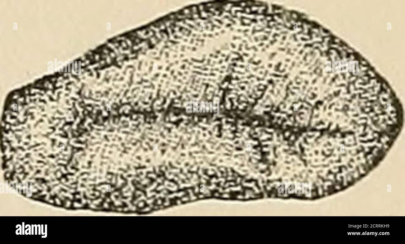 . Descriptive anatomy of the human teeth . Descriptive anatomy of the ...