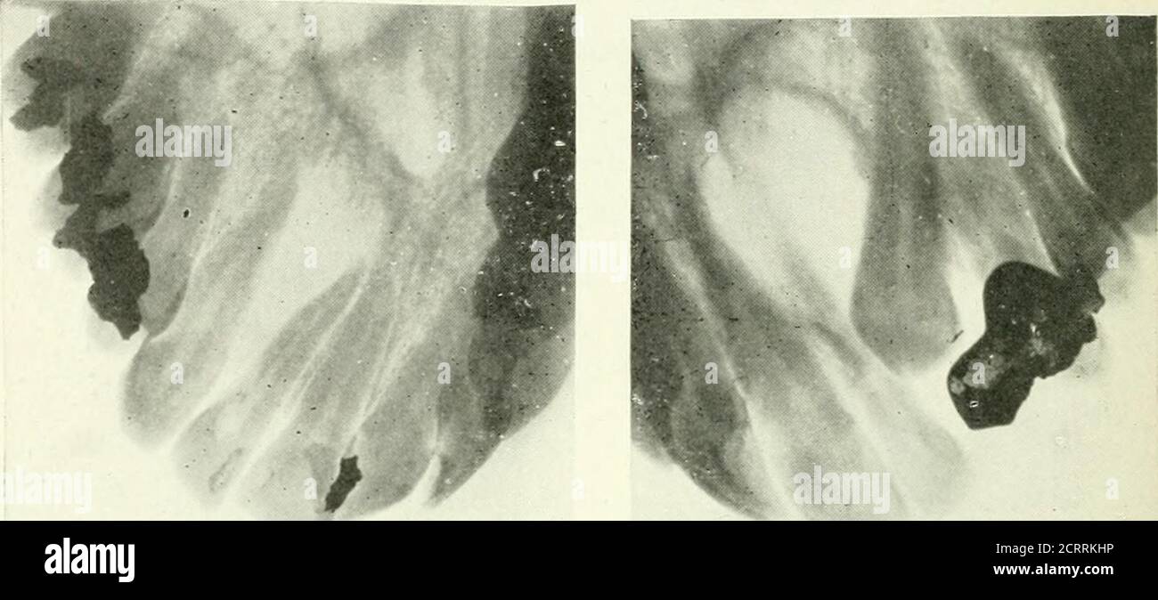 Bony socket hi-res stock photography and images - Alamy