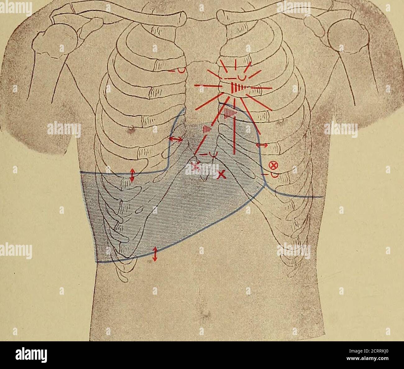 . A practical treatise on medical diagnosis for students and physicians ...