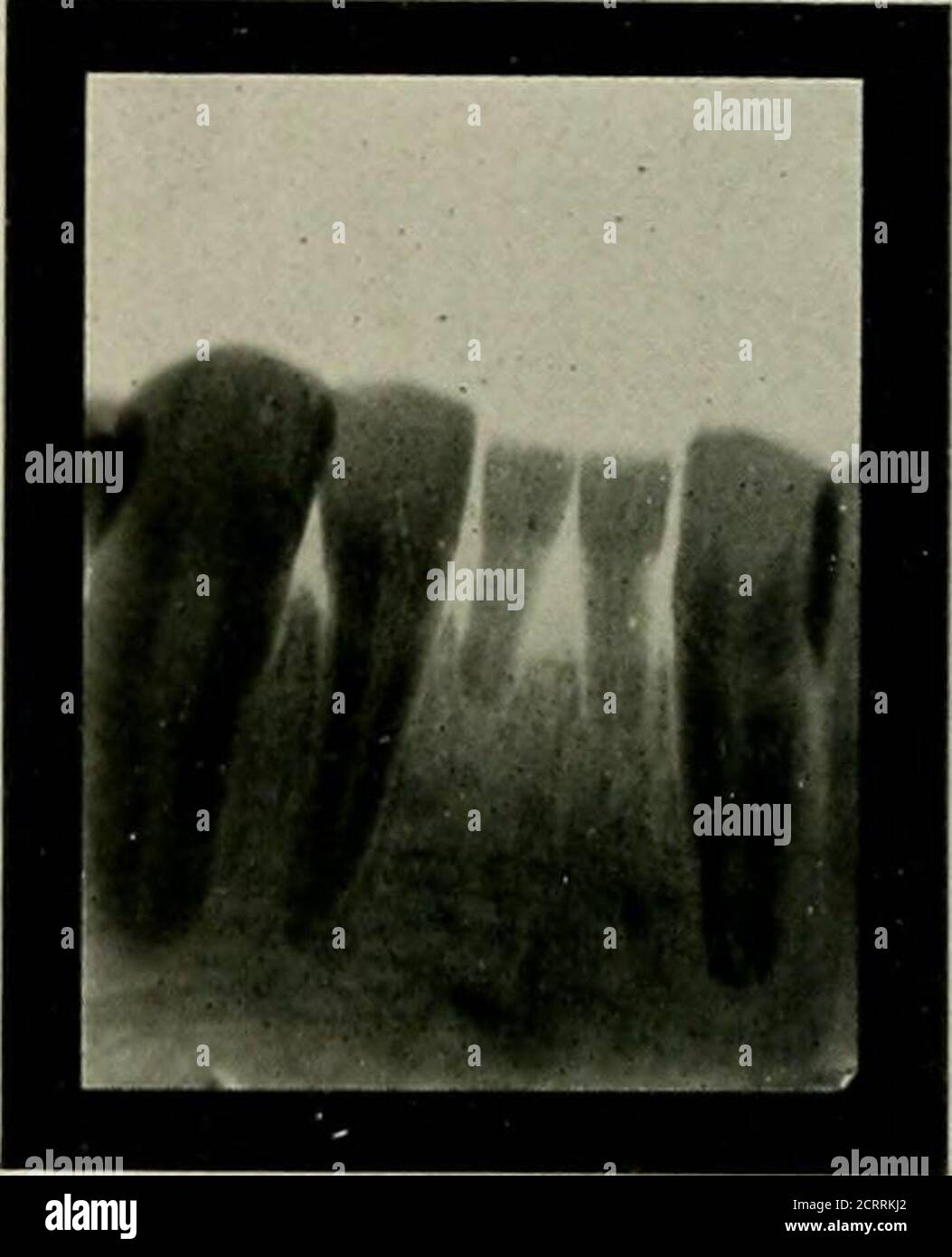. Elementary and dental radiography . Fig. 137. Fig. 138. Fig. 187. Two ...