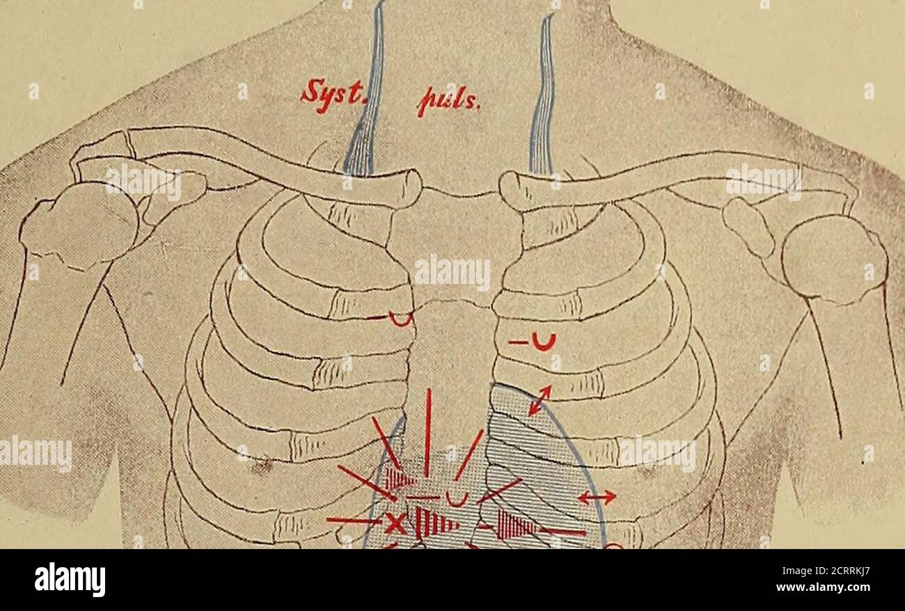 . A practical treatise on medical diagnosis for students and physicians ...