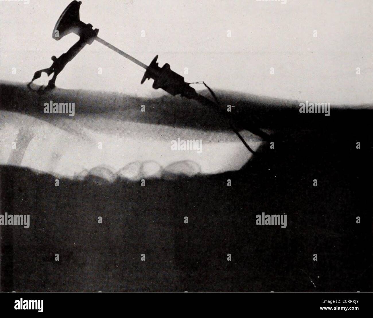 . Journal of radiology . the position of the pubis is the uterus.The ...