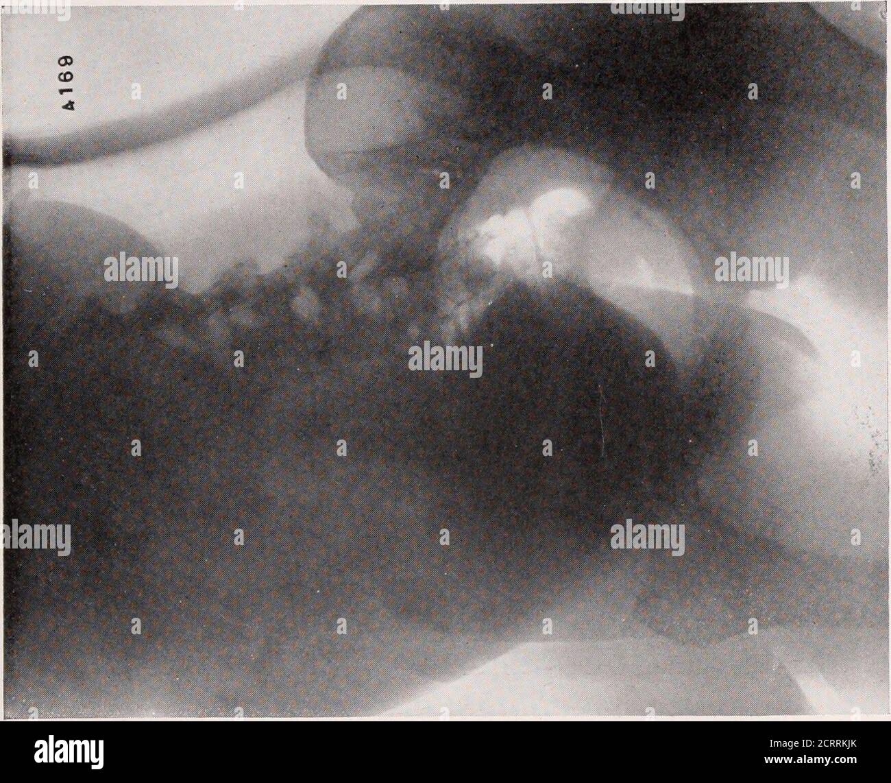 . Journal of radiology . iscovery of a tumor by the patient while ...