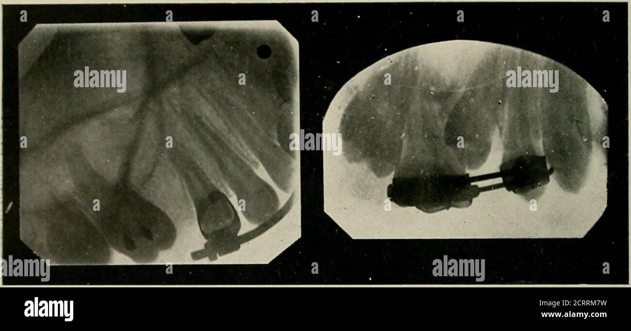 . Elementary and dental radiography . Fig. 129. Fig. 130. Fig. 129 ...