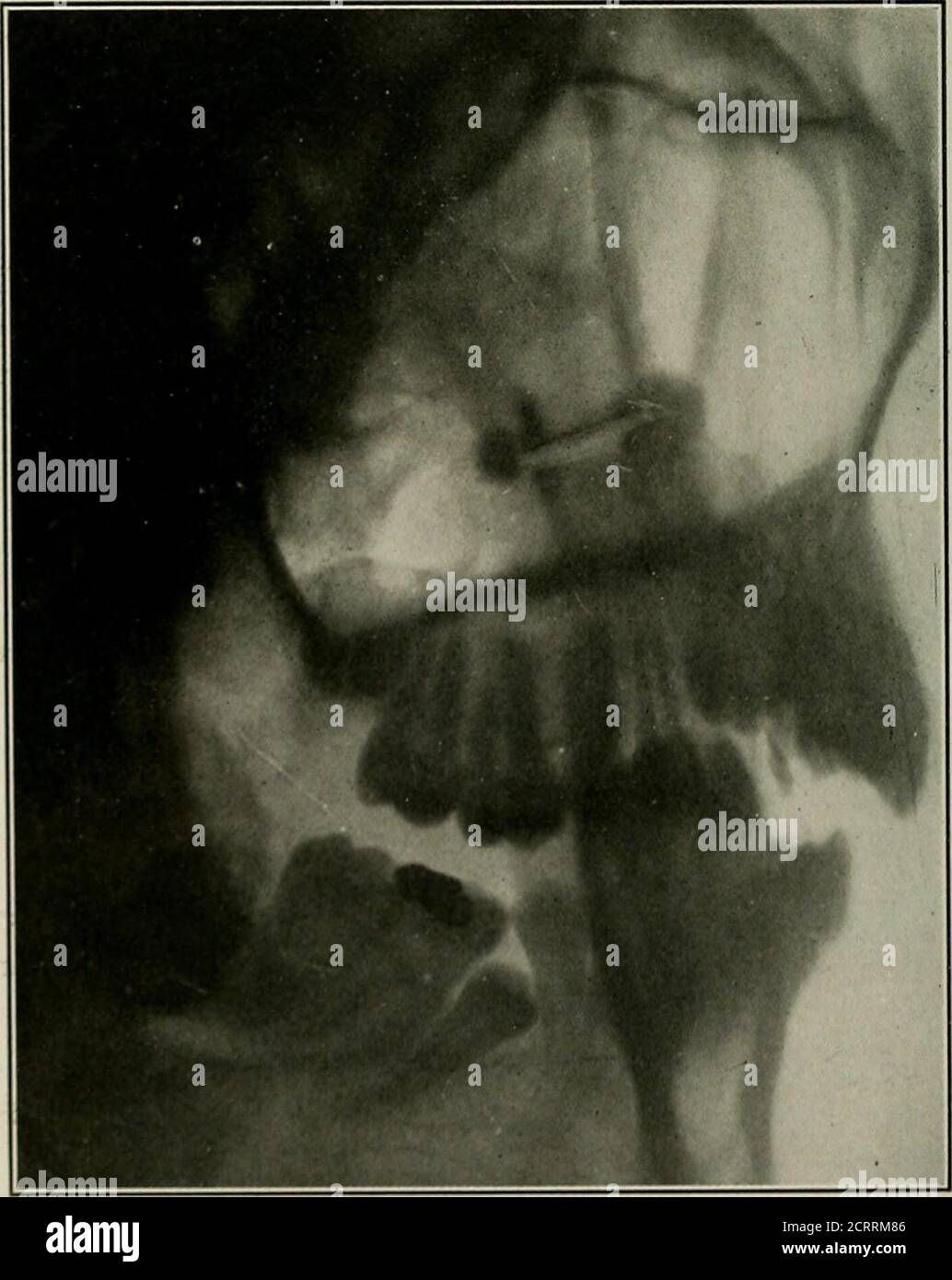 . Elementary and dental radiography . Fig. 131. Fig. 132. Fig. 131 ...