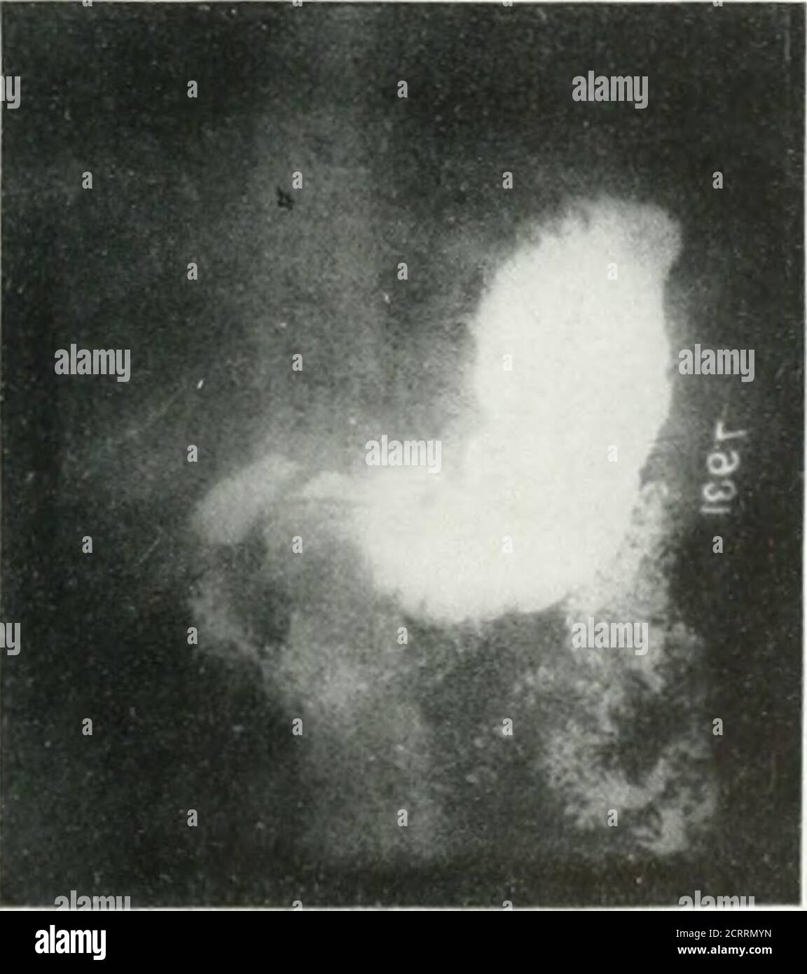 Pyloric junction hi-res stock photography and images - Alamy