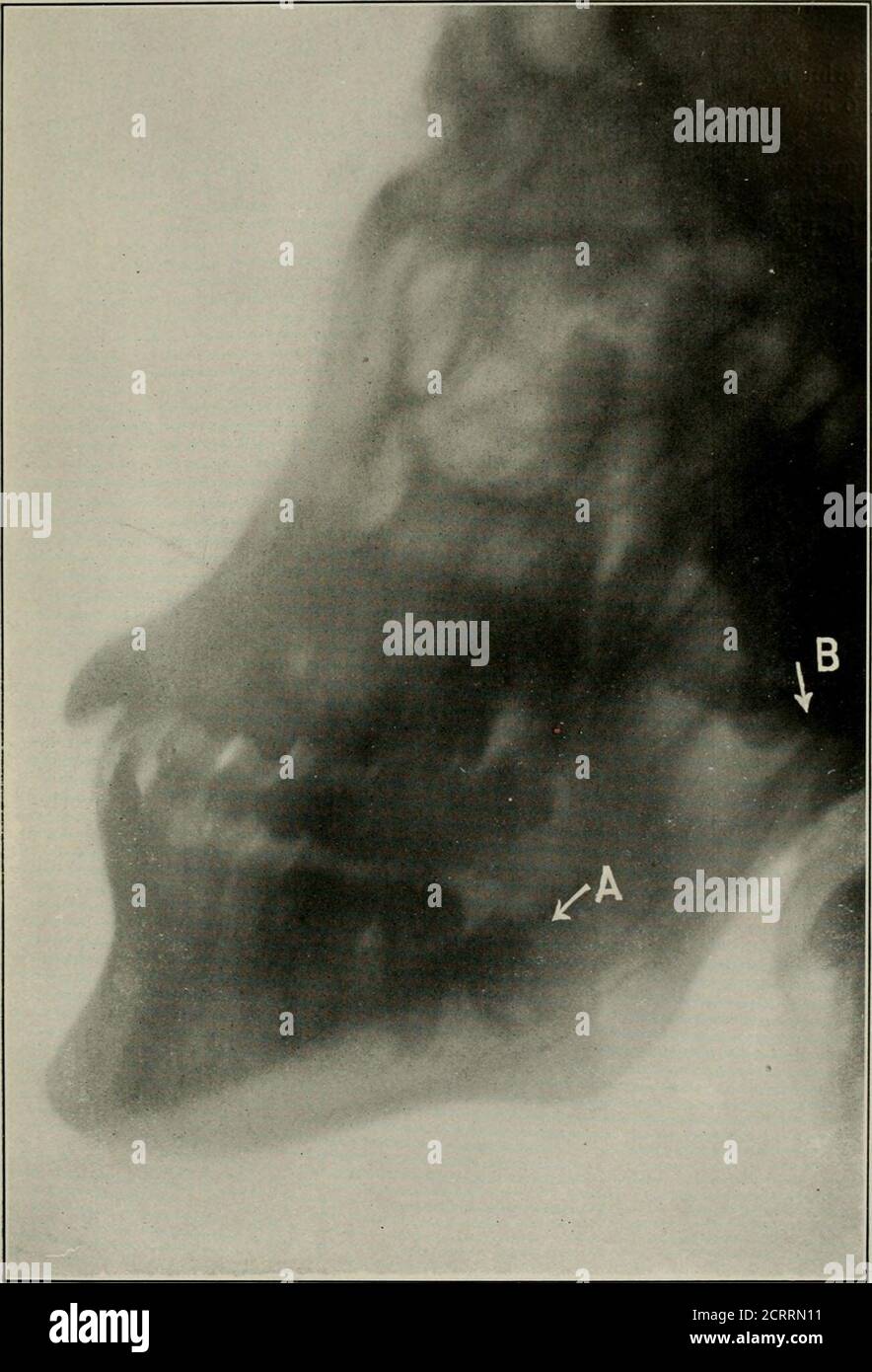 X ray developer hi-res stock photography and images - Alamy