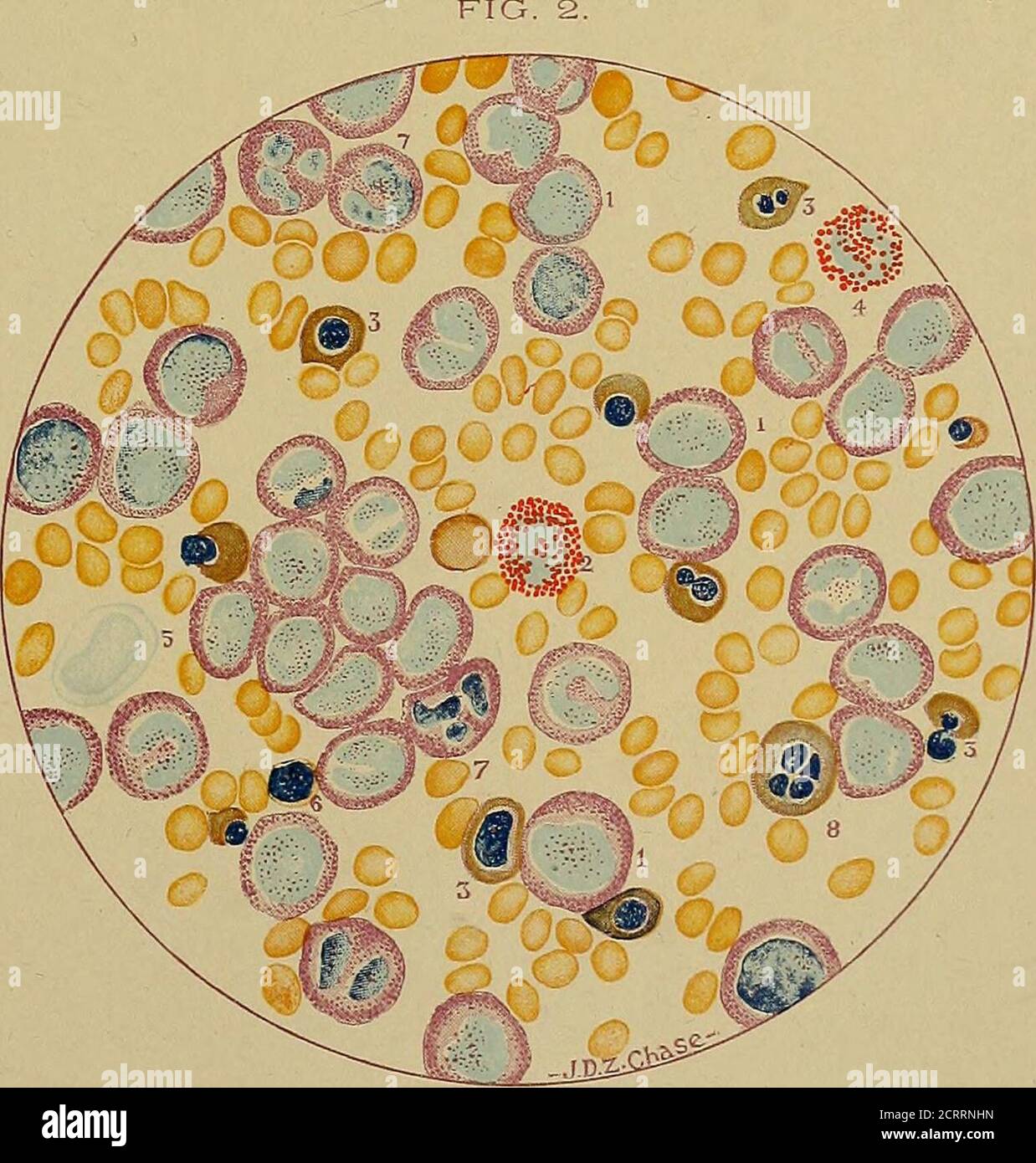 . A practical treatise on medical diagnosis for students and physicians ...