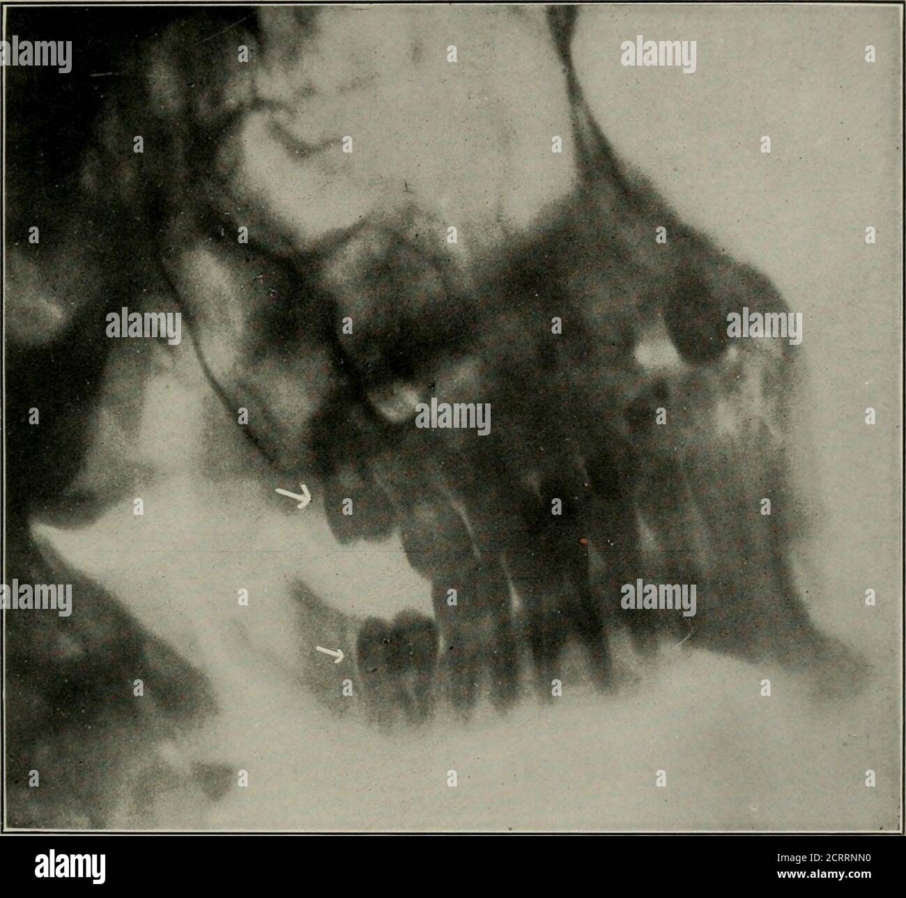 Recumbent pose hi-res stock photography and images - Alamy