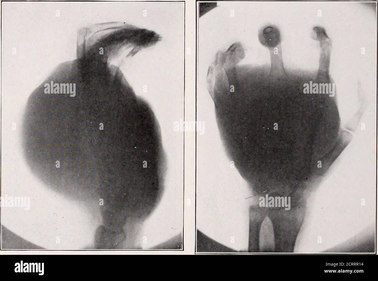 Giant middle finger hi-res stock photography and images - Alamy