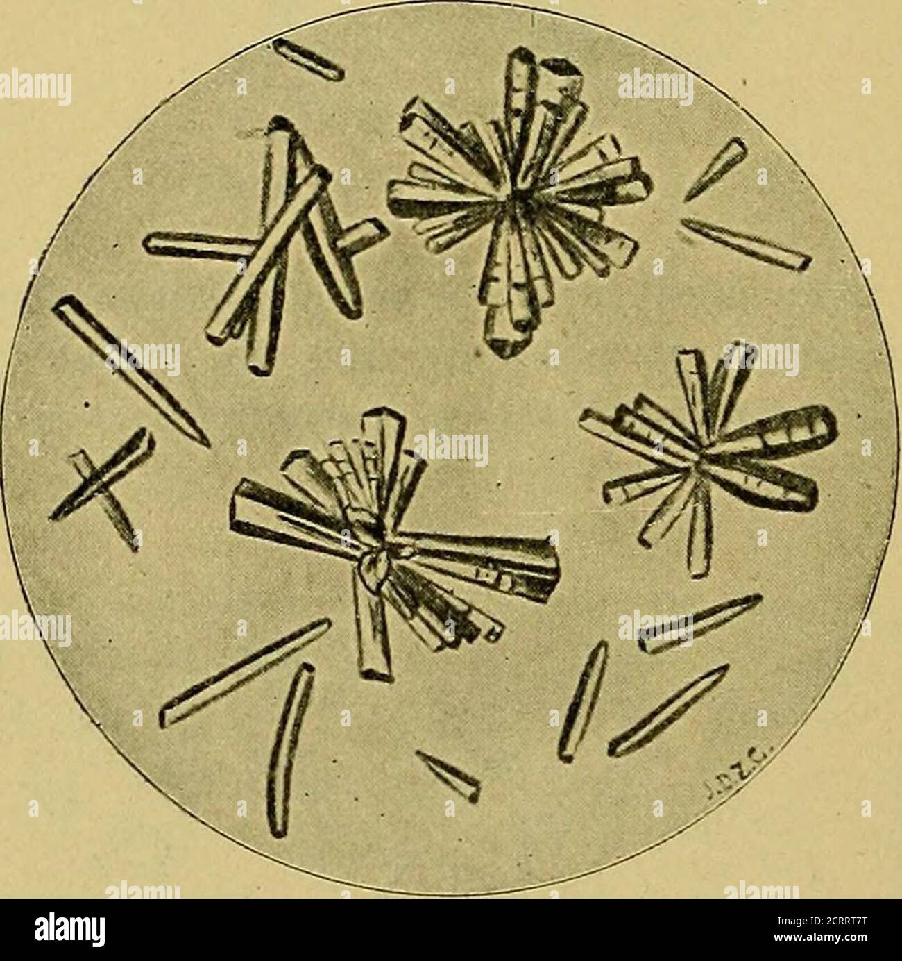 Calcium Phosphate In Urine