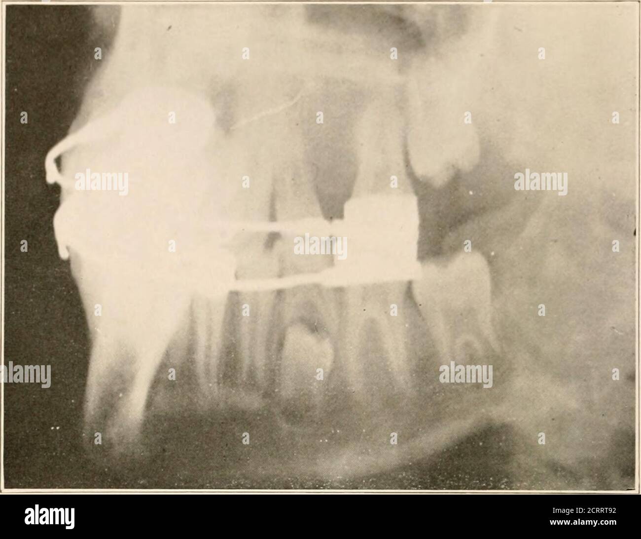 . Dental and oral radiography : a textbook for students and ...