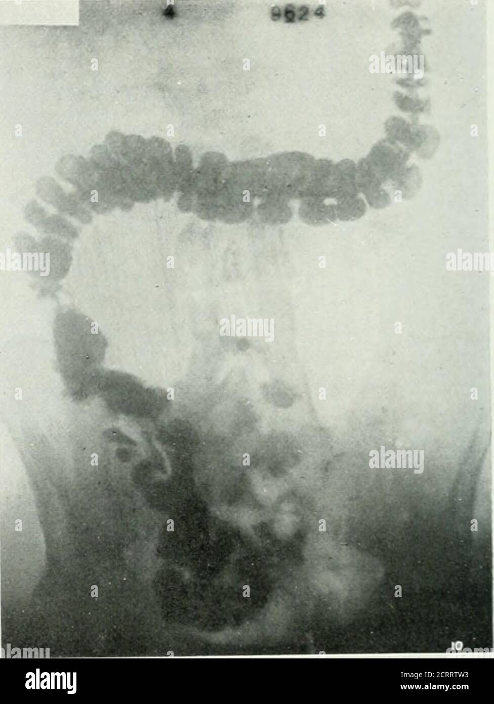 . The American journal of roentgenology, radium therapy and nuclear ...