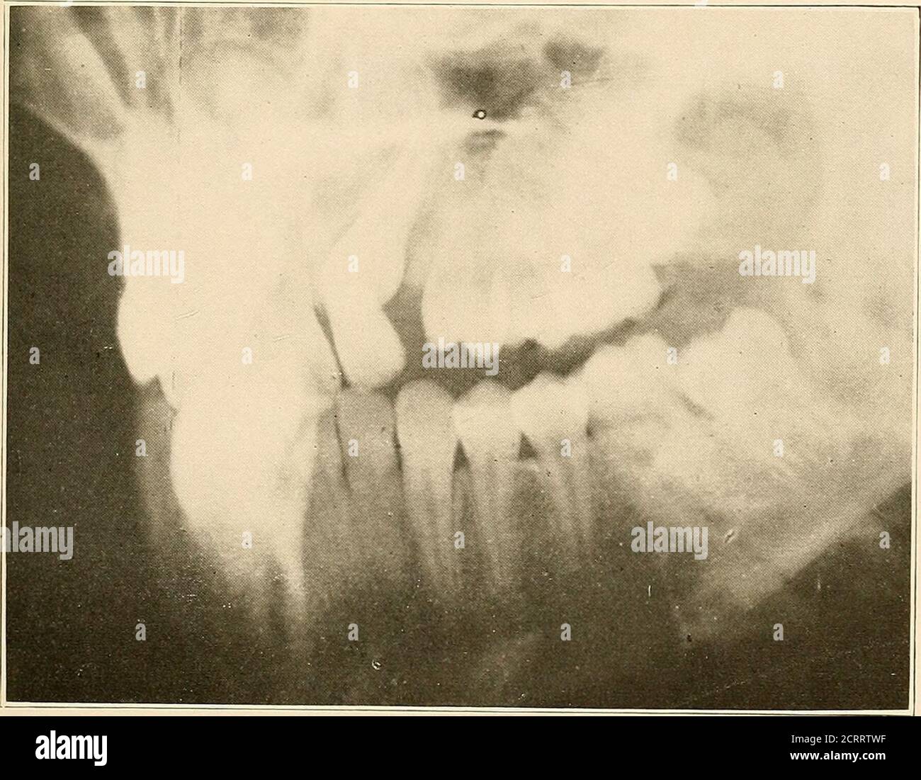 . Dental and oral radiography : a textbook for students and ...