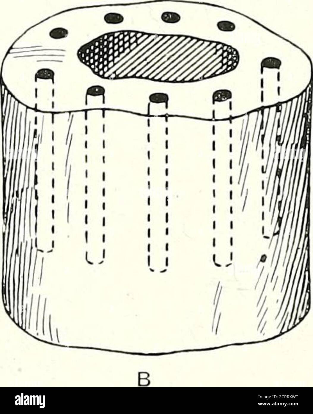 Transverse Saw High Resolution Stock Photography and Images - Alamy
