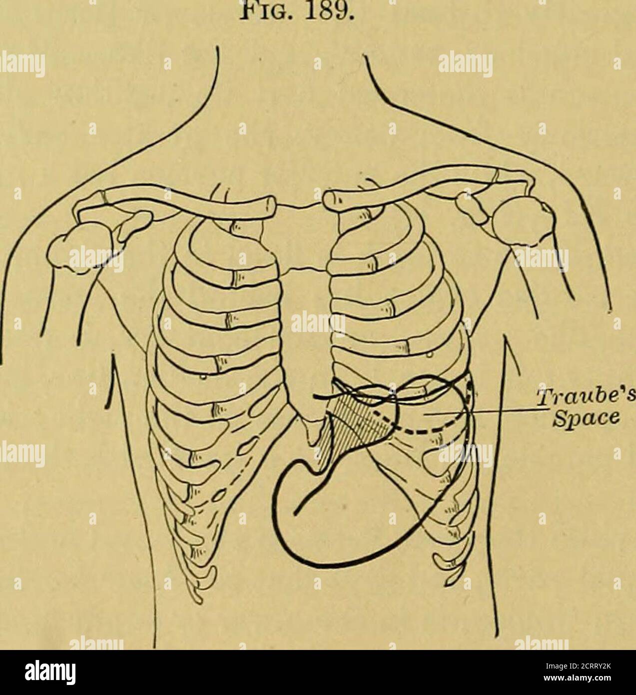 Sixth rib hi-res stock photography and images - Alamy
