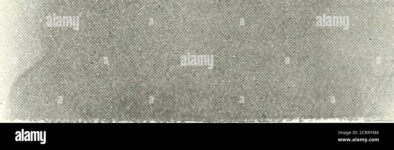 Lateral femoral condyle hi-res stock photography and images - Alamy