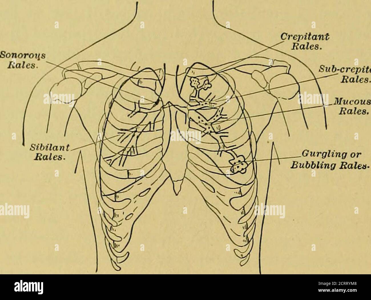 Mucopurulent hi-res stock photography and images - Alamy