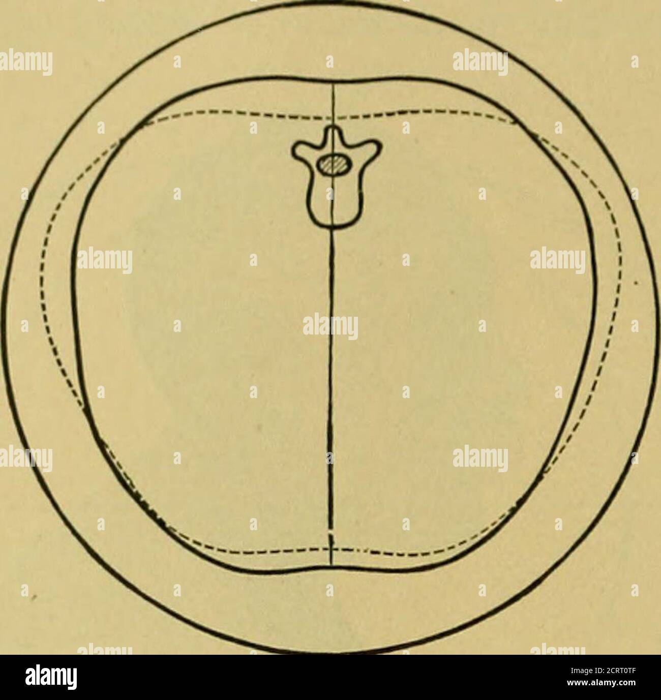 . A practical treatise on medical diagnosis for students and physicians ...