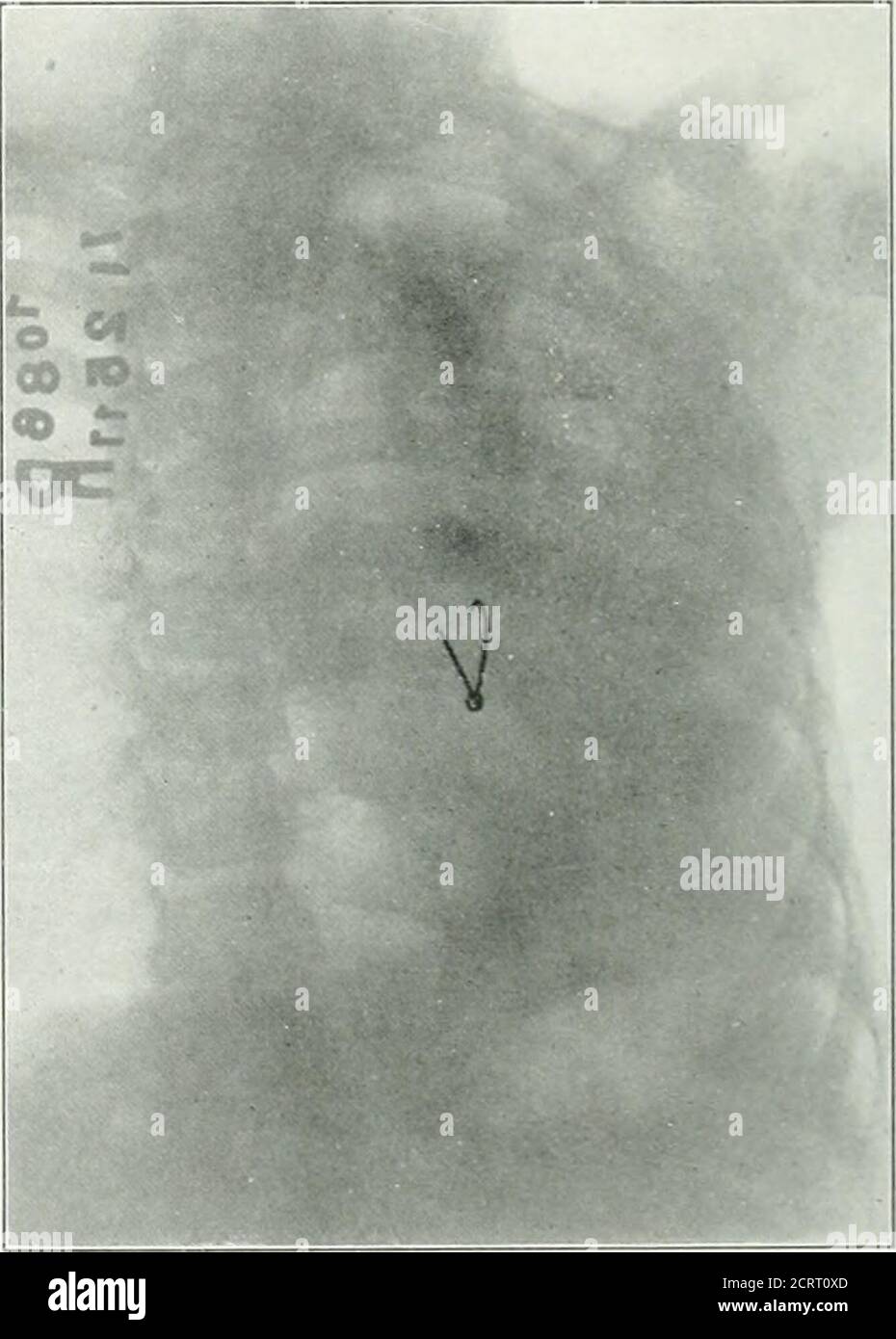 Safetypin hi-res stock photography and images - Alamy