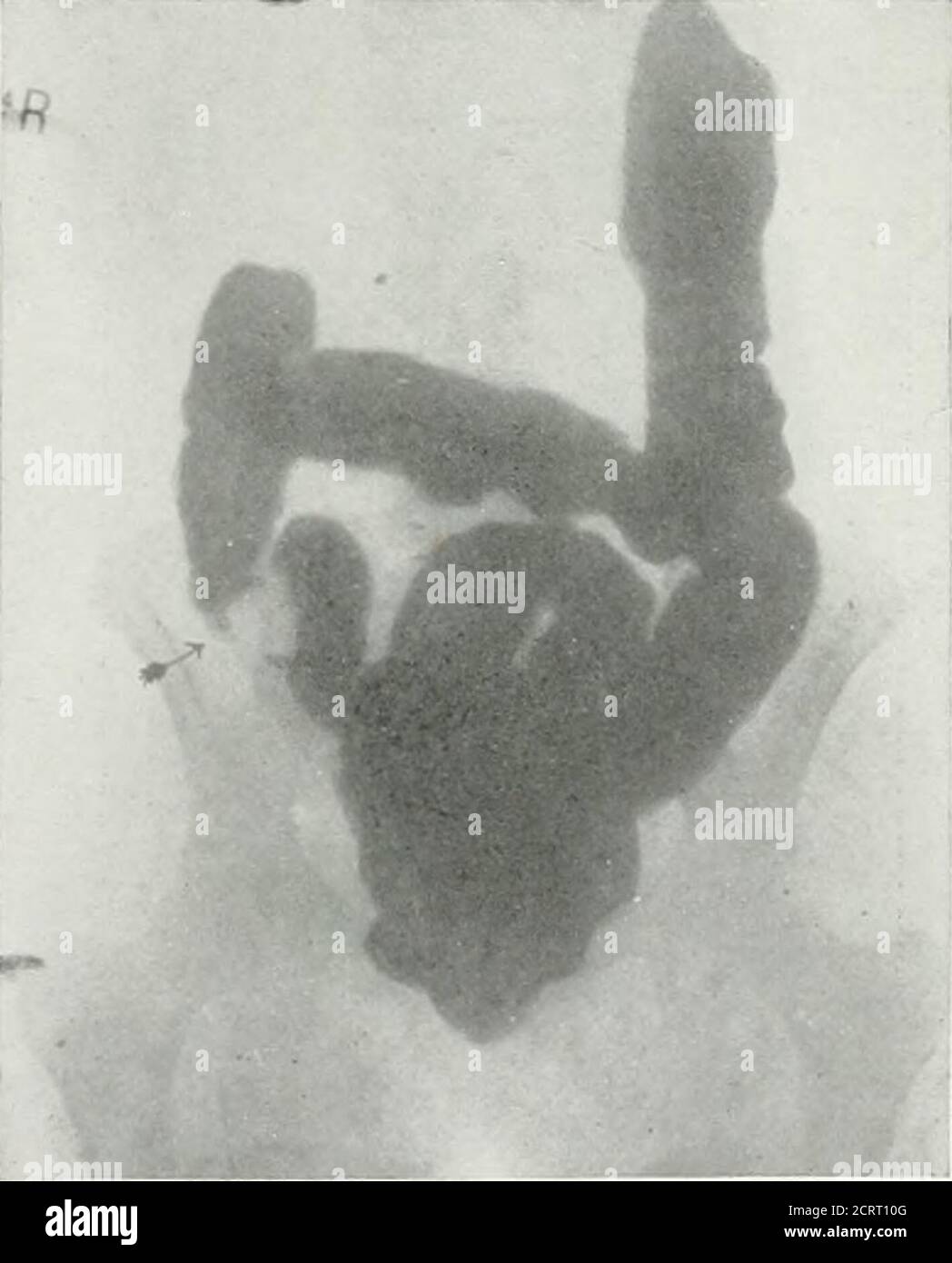 . The American journal of roentgenology, radium therapy and nuclear ...