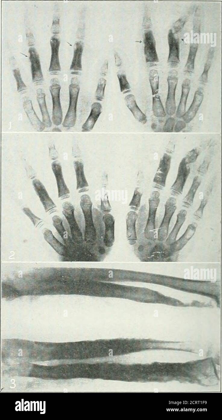 . The American journal of roentgenology, radium therapy and nuclear ...