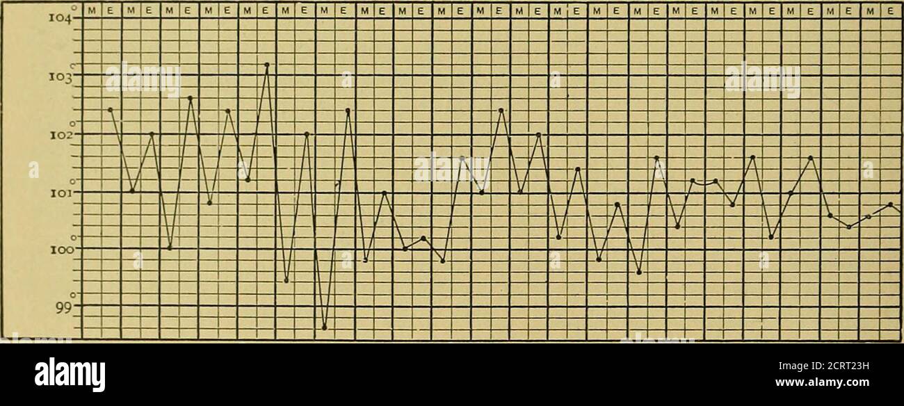 Pyaemia hi-res stock photography and images - Alamy