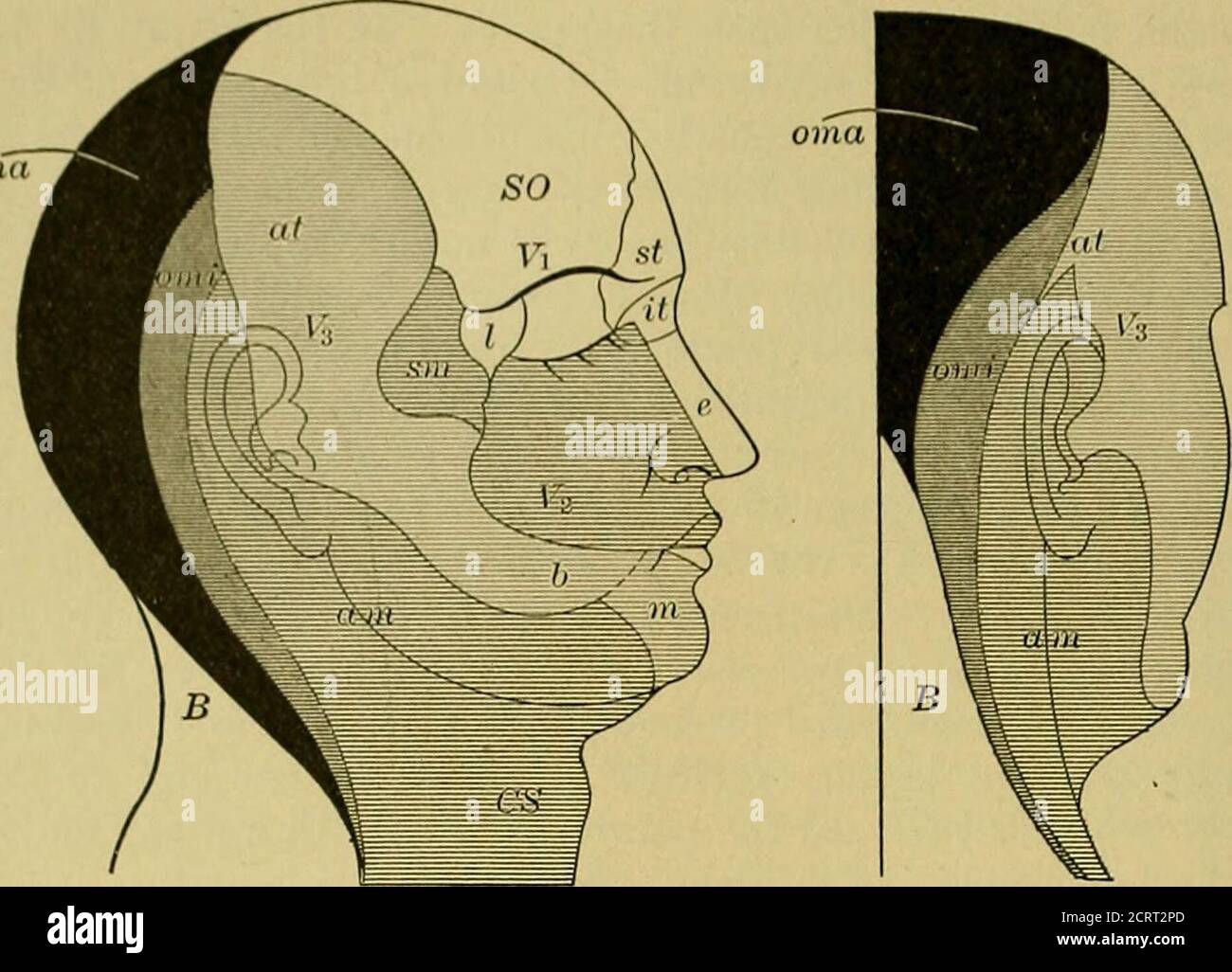 Comatose patient hi-res stock photography and images - Alamy