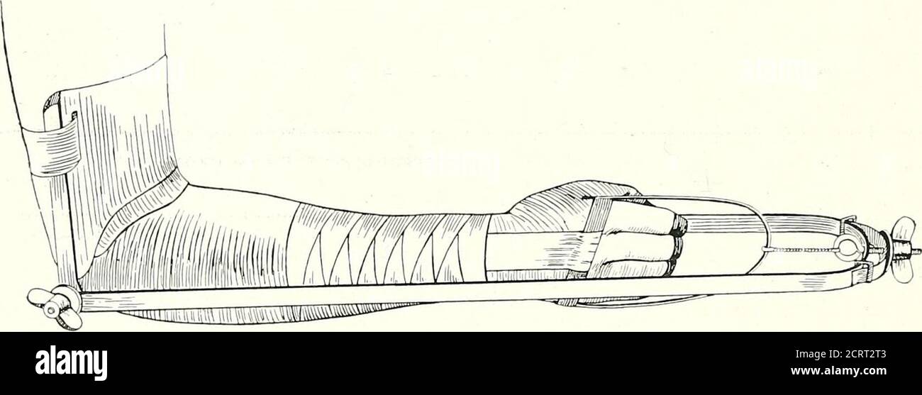 Long extension arm hi-res stock photography and images - Alamy