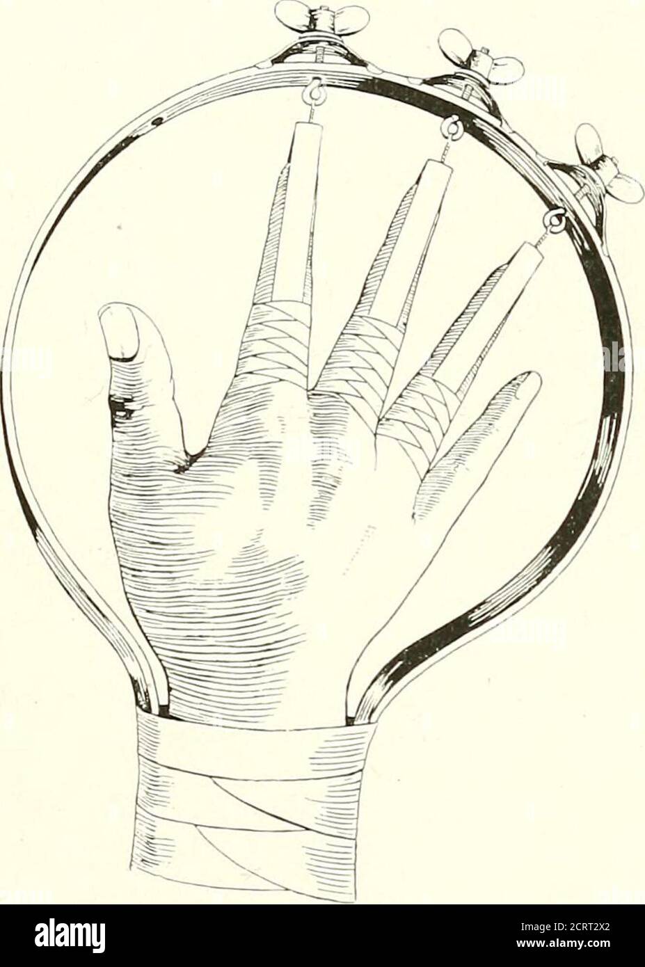 Extensor surfaces hi-res stock photography and images - Alamy