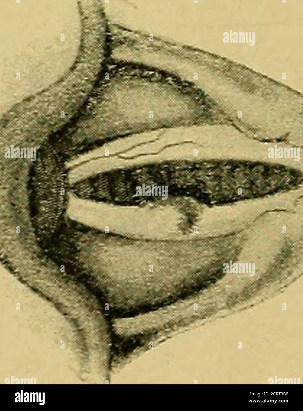 Trachea mucous membrane hi-res stock photography and images - Alamy