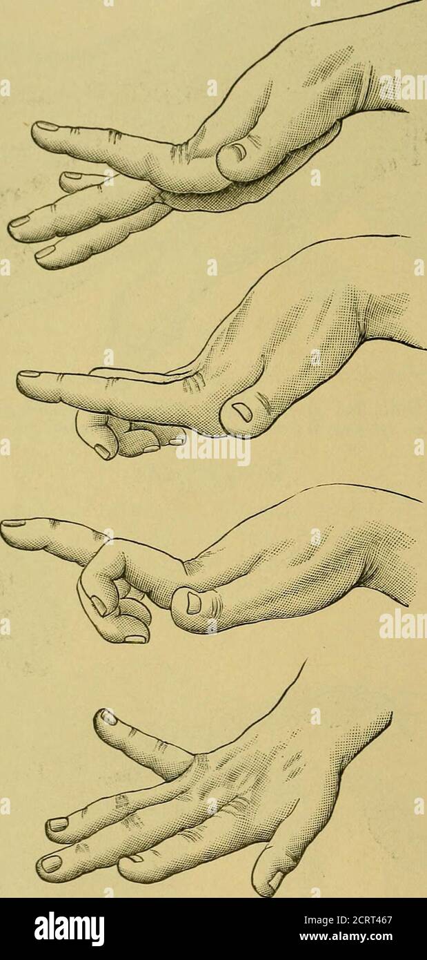 . A practical treatise on medical diagnosis for students and physicians ...