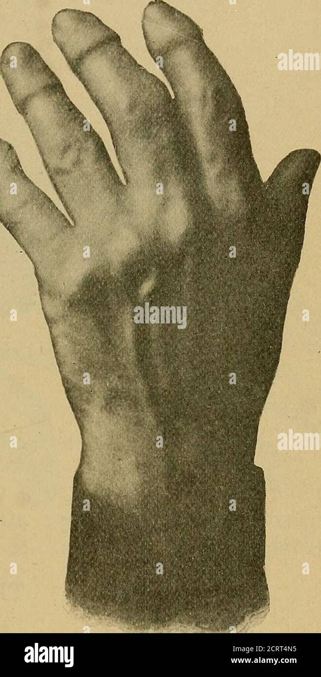 . A practical treatise on medical diagnosis for students and physicians ...
