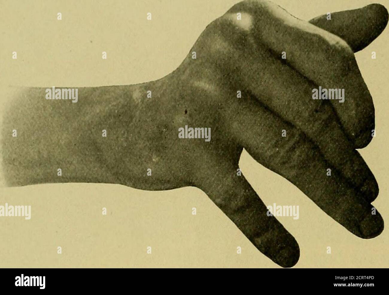 . A practical treatise on medical diagnosis for students and physicians ...