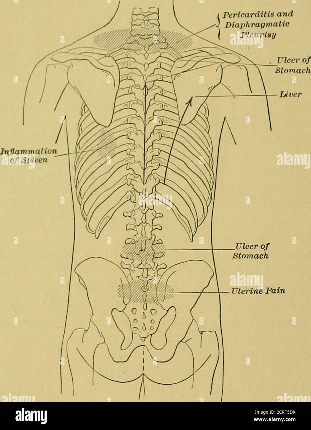 Midscapular Line