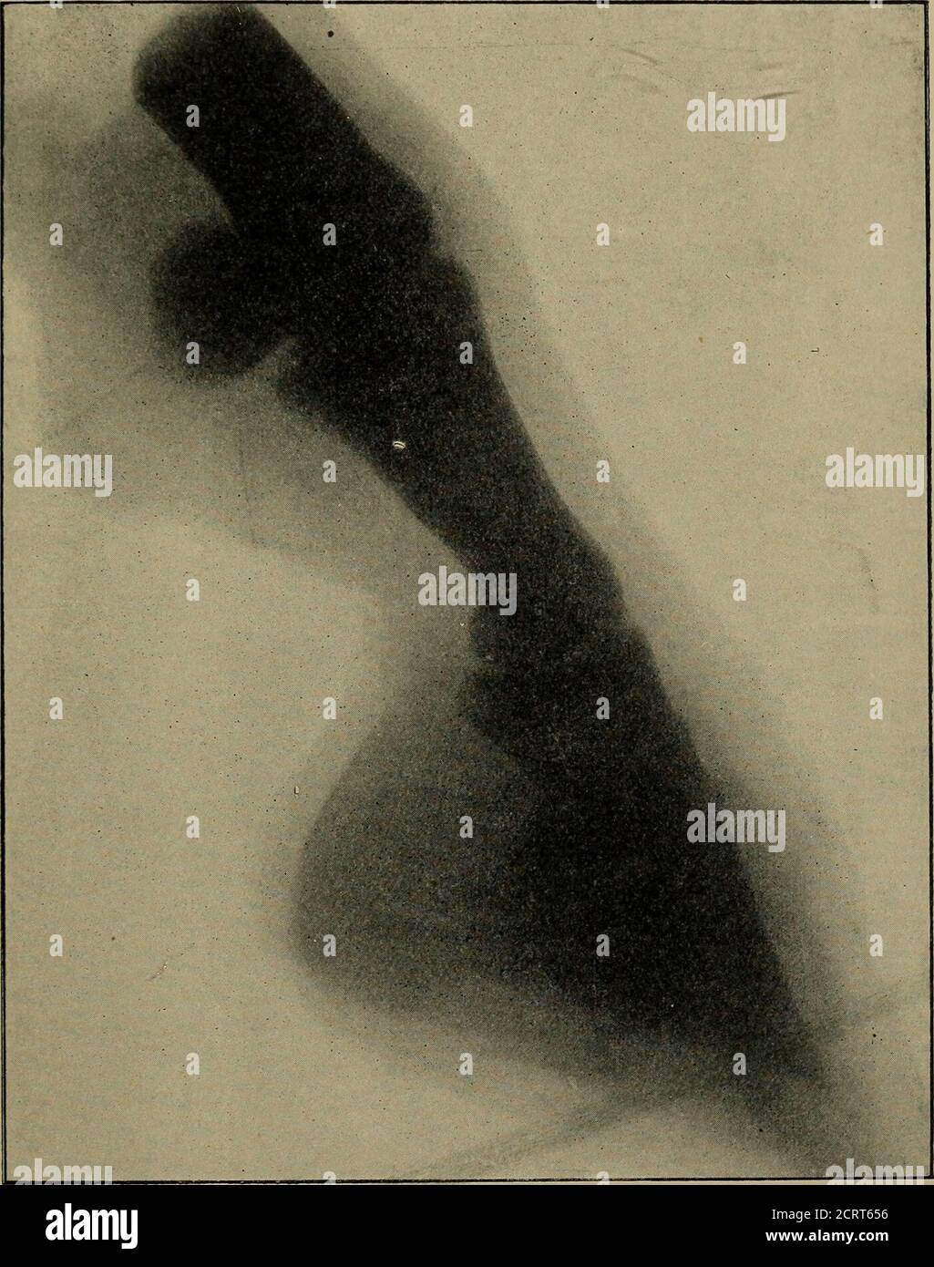. The Röntgen rays in medical work . an be applied successfully. With ...