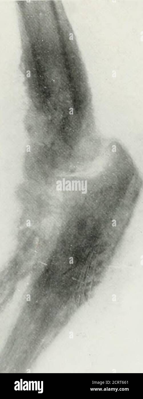 . The American journal of roentgenology, radium therapy and nuclear ...