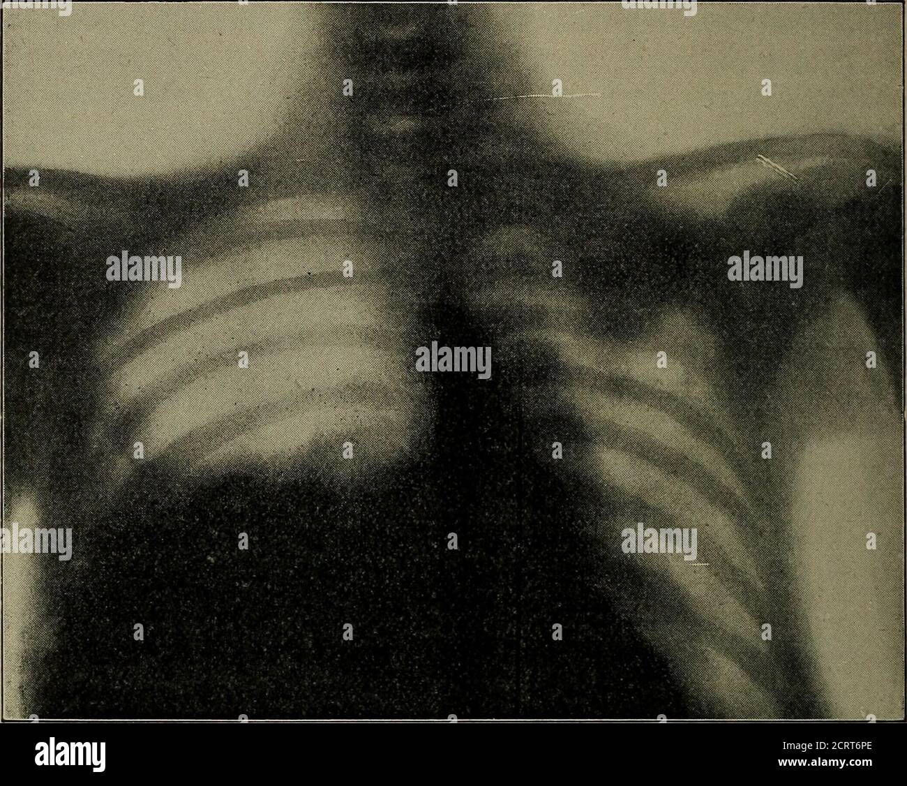 . The Röntgen rays in medical work . RONTGEN RA YS IN MEDICAL WORK ...