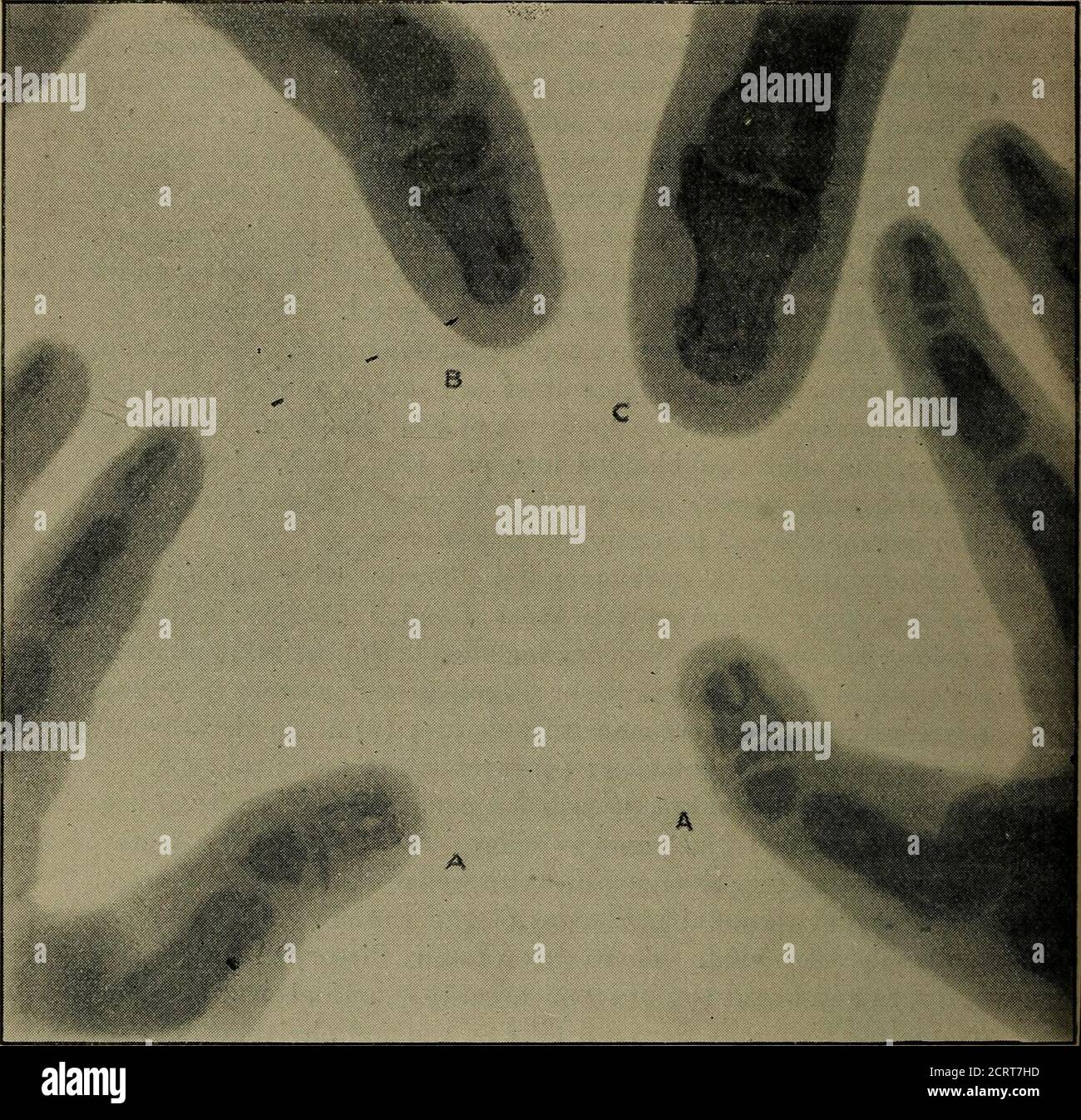 Bifid thumb hi-res stock photography and images - Alamy