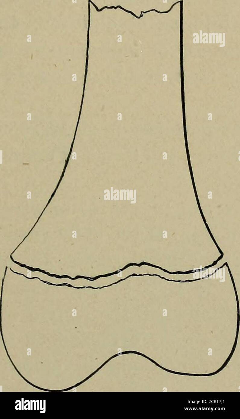 . The Röntgen rays in medical work . 426 Lower Extremity. Femur ...