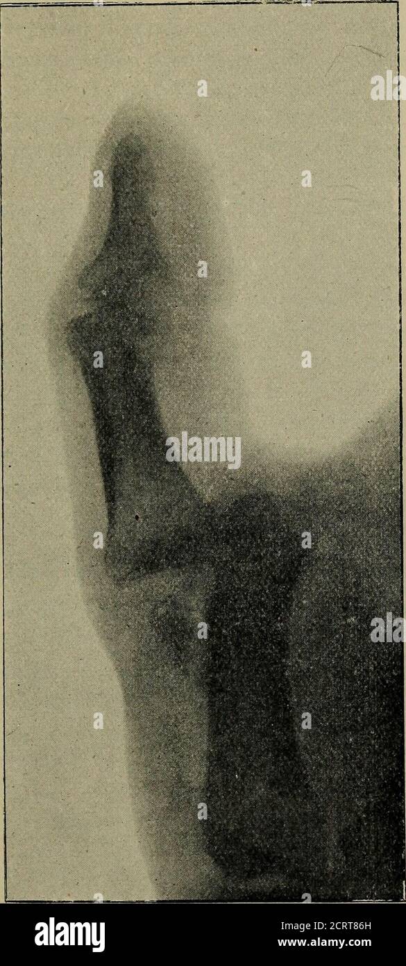 Anatomical distortion hi-res stock photography and images - Alamy
