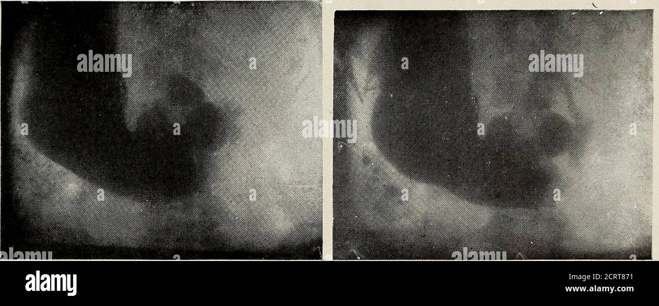 . American quarterly of roentgenology . Figure 3.Four stomach plates ...