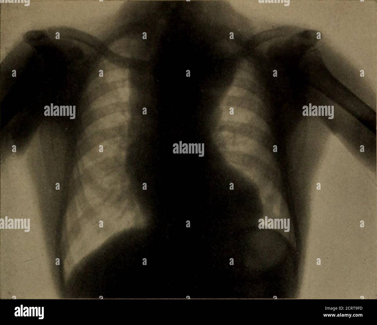 . X-ray apparatus : complete outfits and accessories for X-ray ...