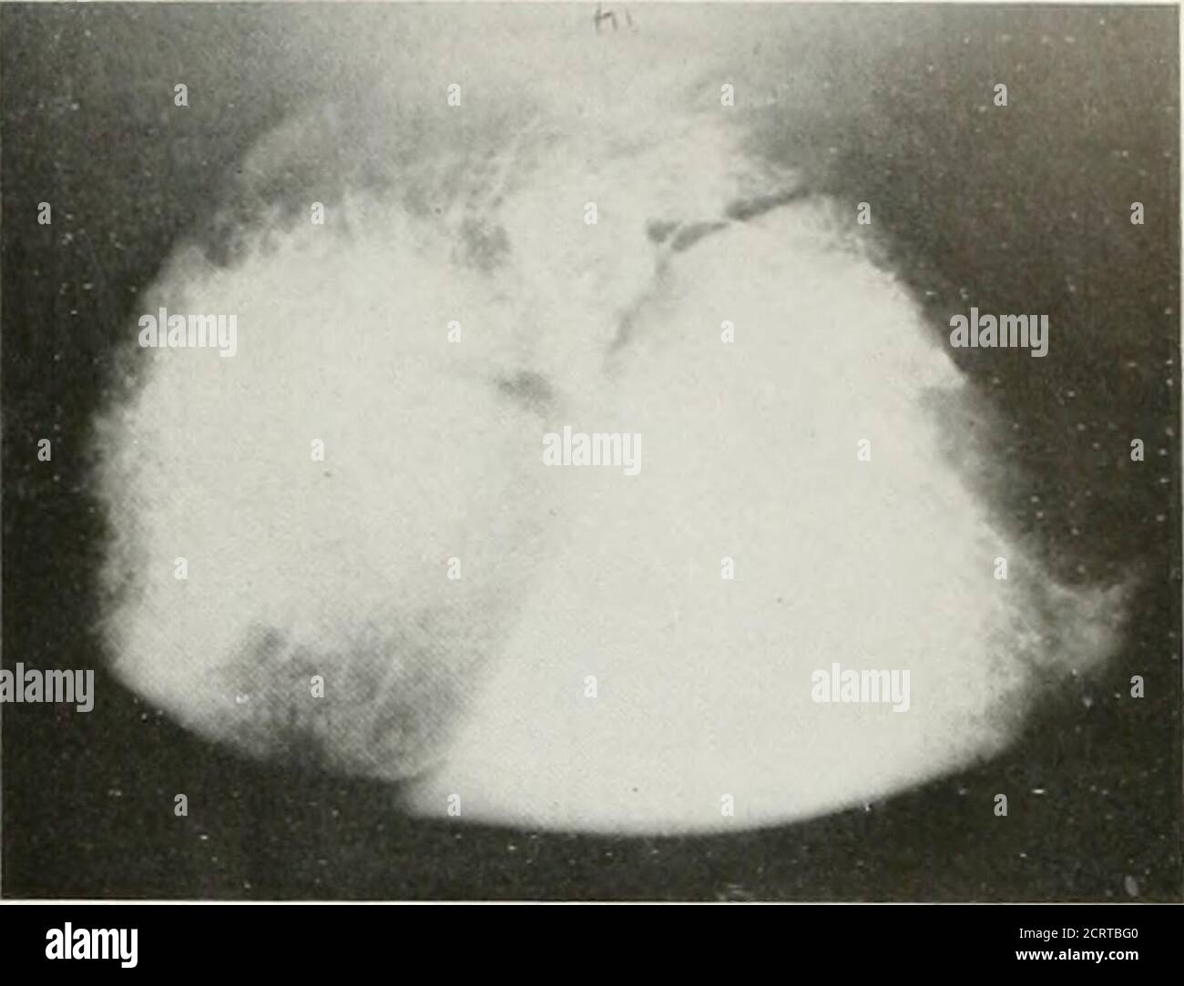 . The American journal of roentgenology, radium therapy and nuclear ...