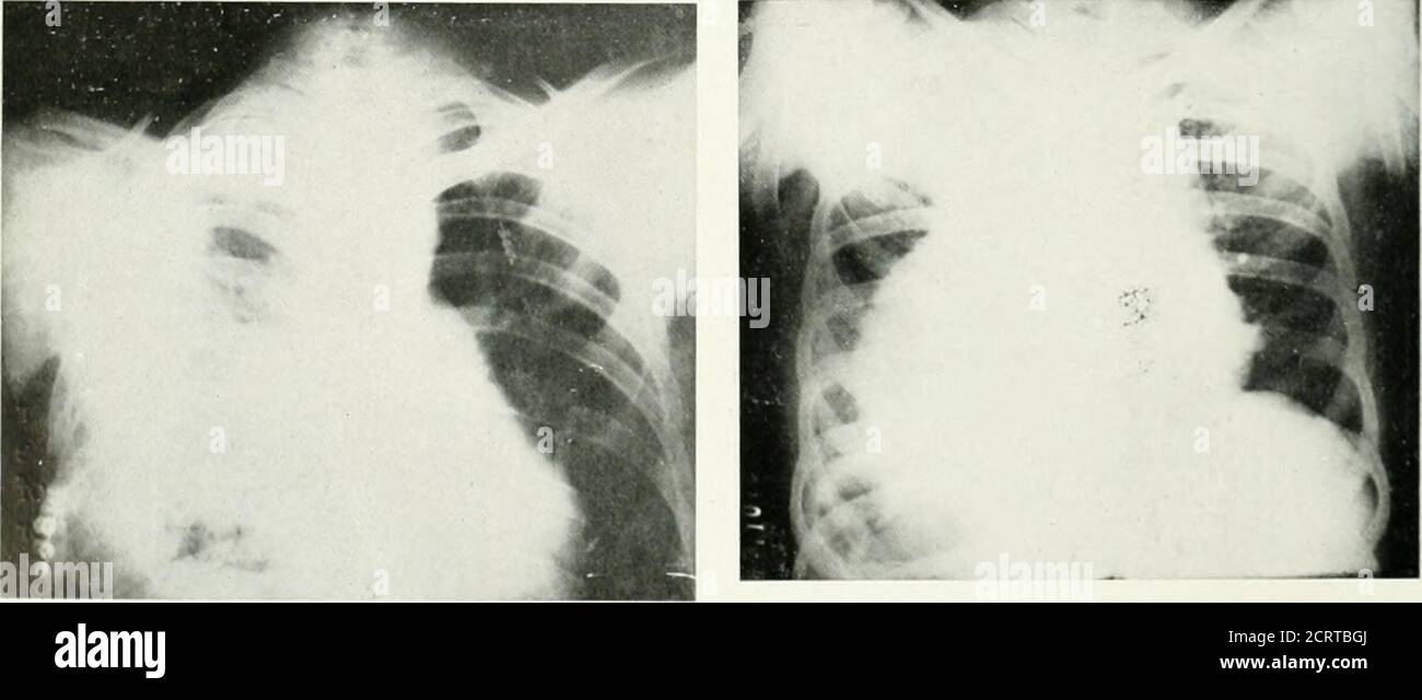 . The American journal of roentgenology, radium therapy and nuclear ...