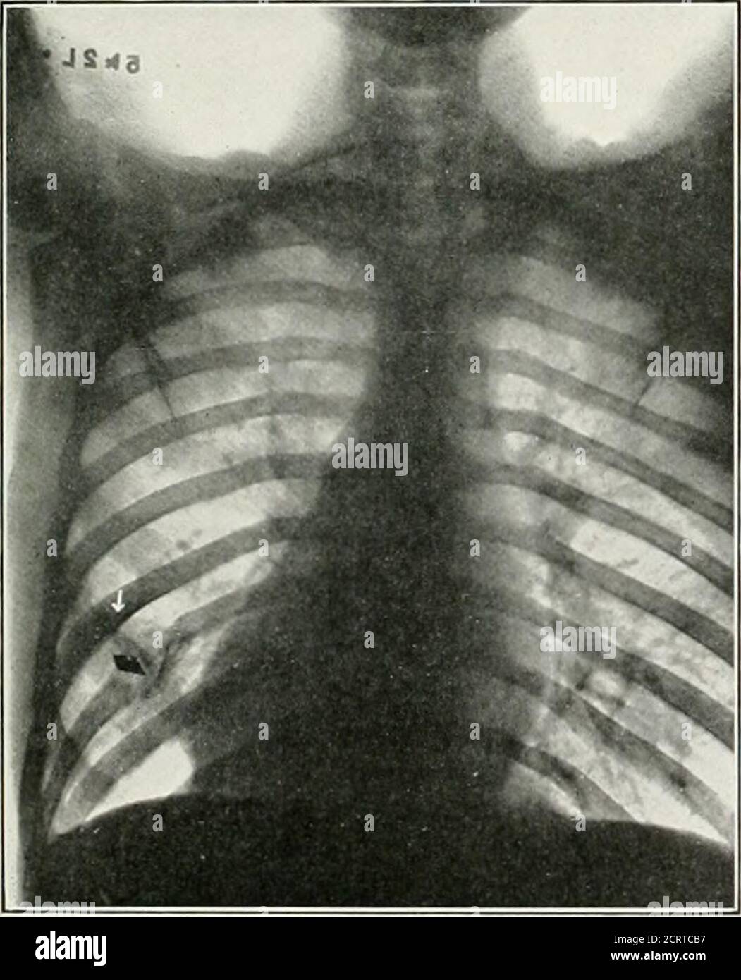 . The American journal of roentgenology, radium therapy and nuclear ...