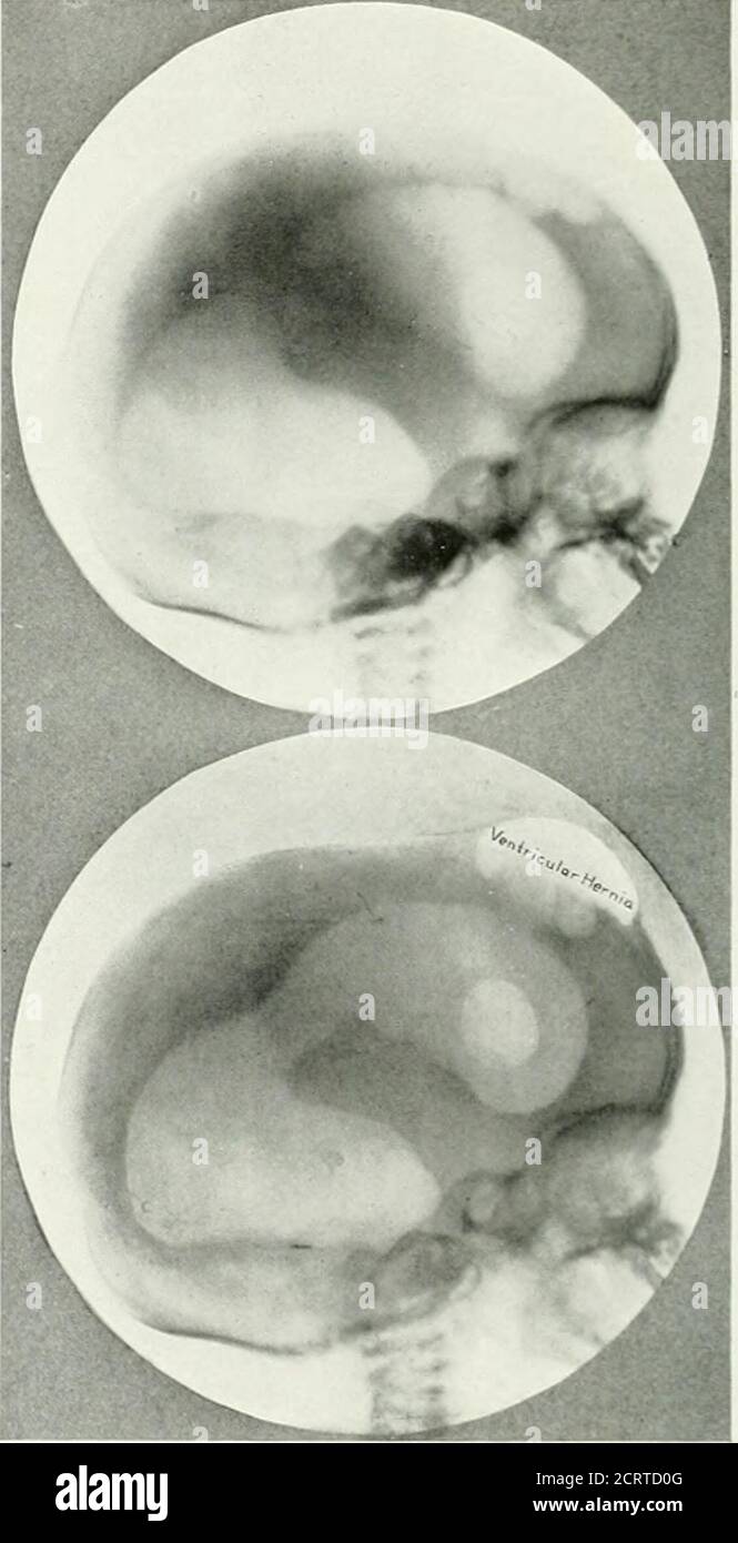 Nuclear medicine injection hi-res stock photography and images - Alamy