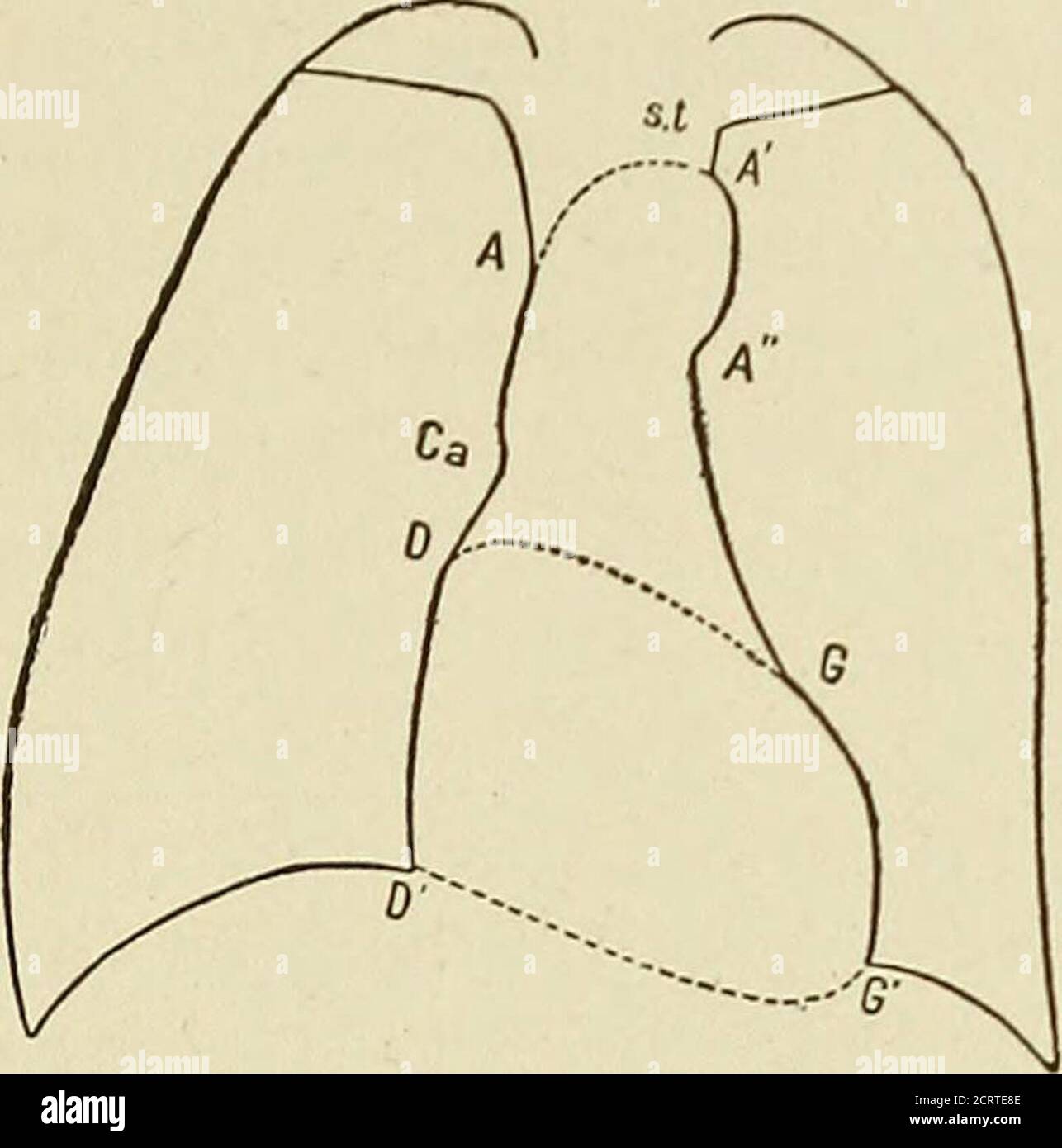. The heart and the aorta; studies in clinical radiology . Radioscopic ...