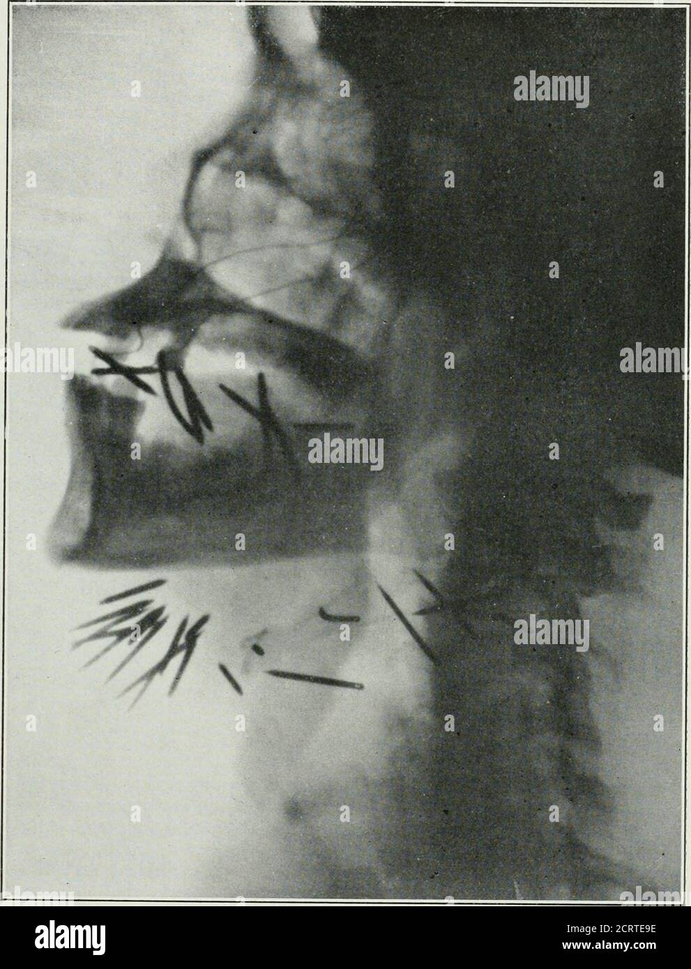 . Radium . f cancer, at least not until very late. So great isthe ...