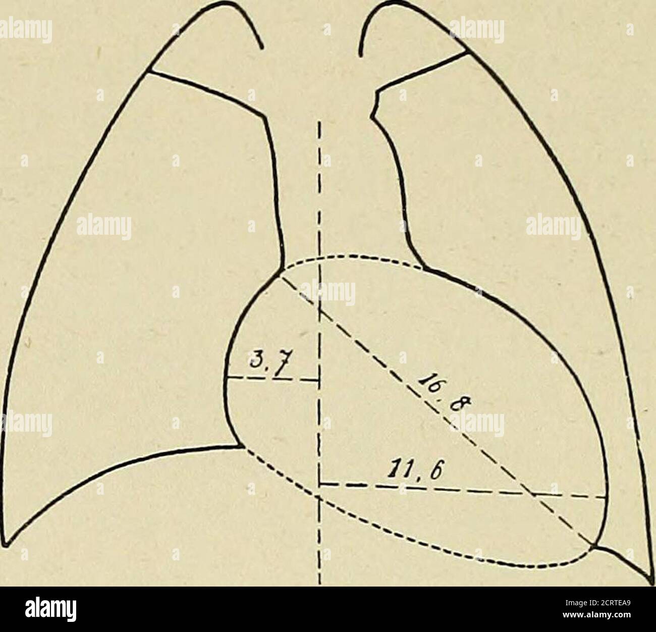 . The heart and the aorta; studies in clinical radiology . ase of ...
